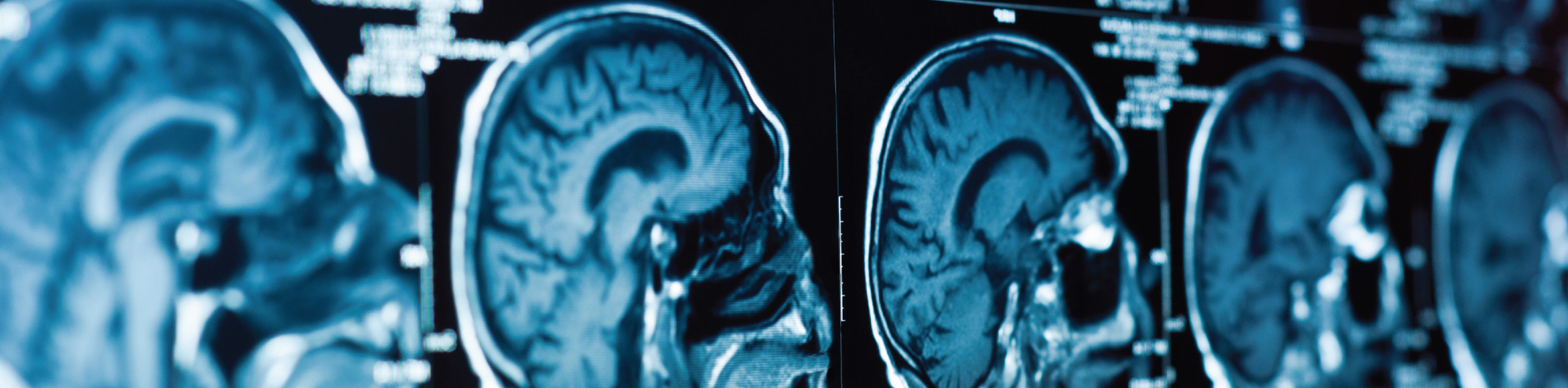 Direct Research - Lindamood-Bell - Small or absent Visual Word Form ...